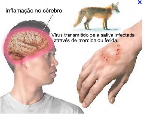 Rainha Maria - Paciente com raiva humana morre após um mês internado em ...